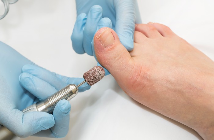 Jalkojen hoito :: Jalka Piste